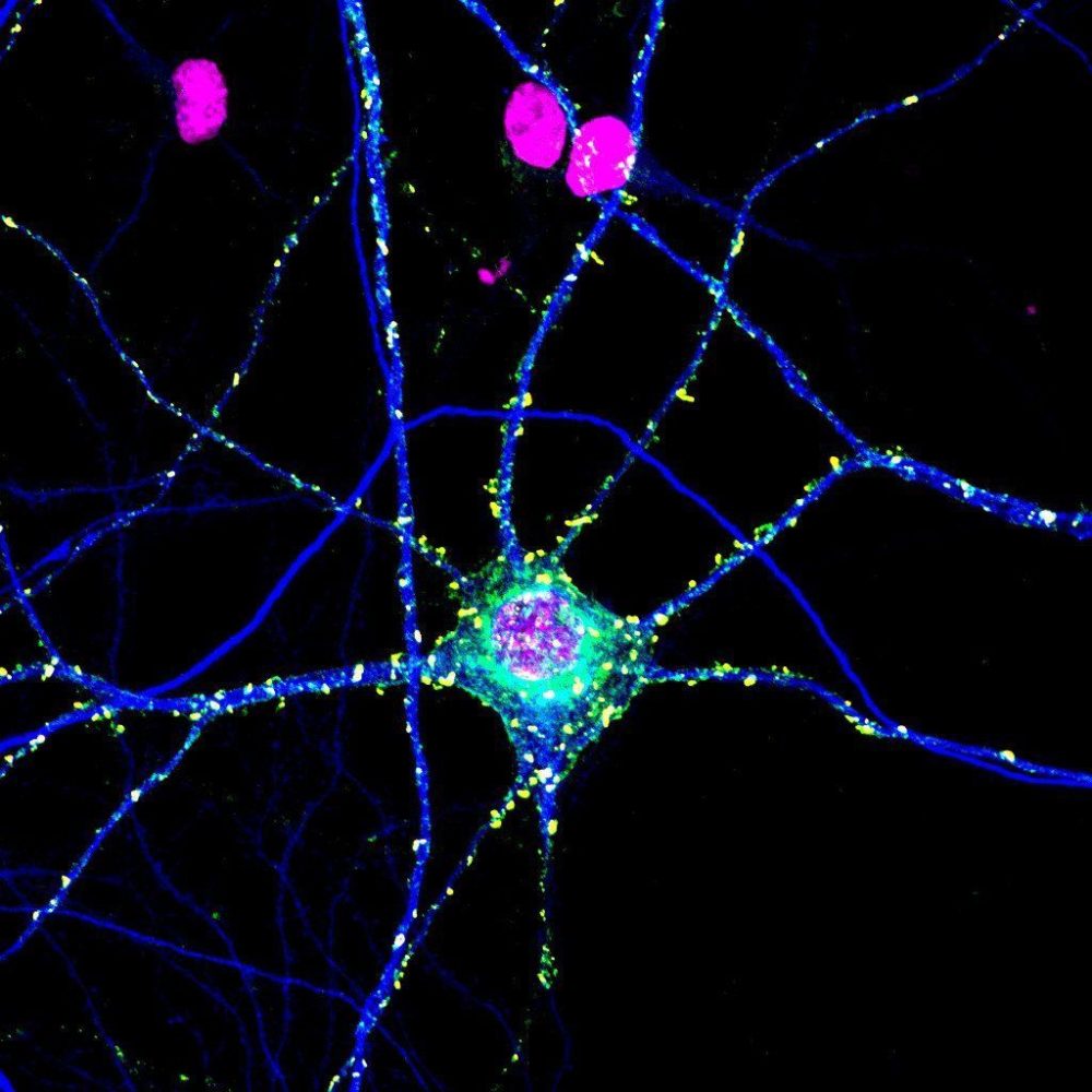 signaling-in-neurons-NIH.jpg - Genotipia