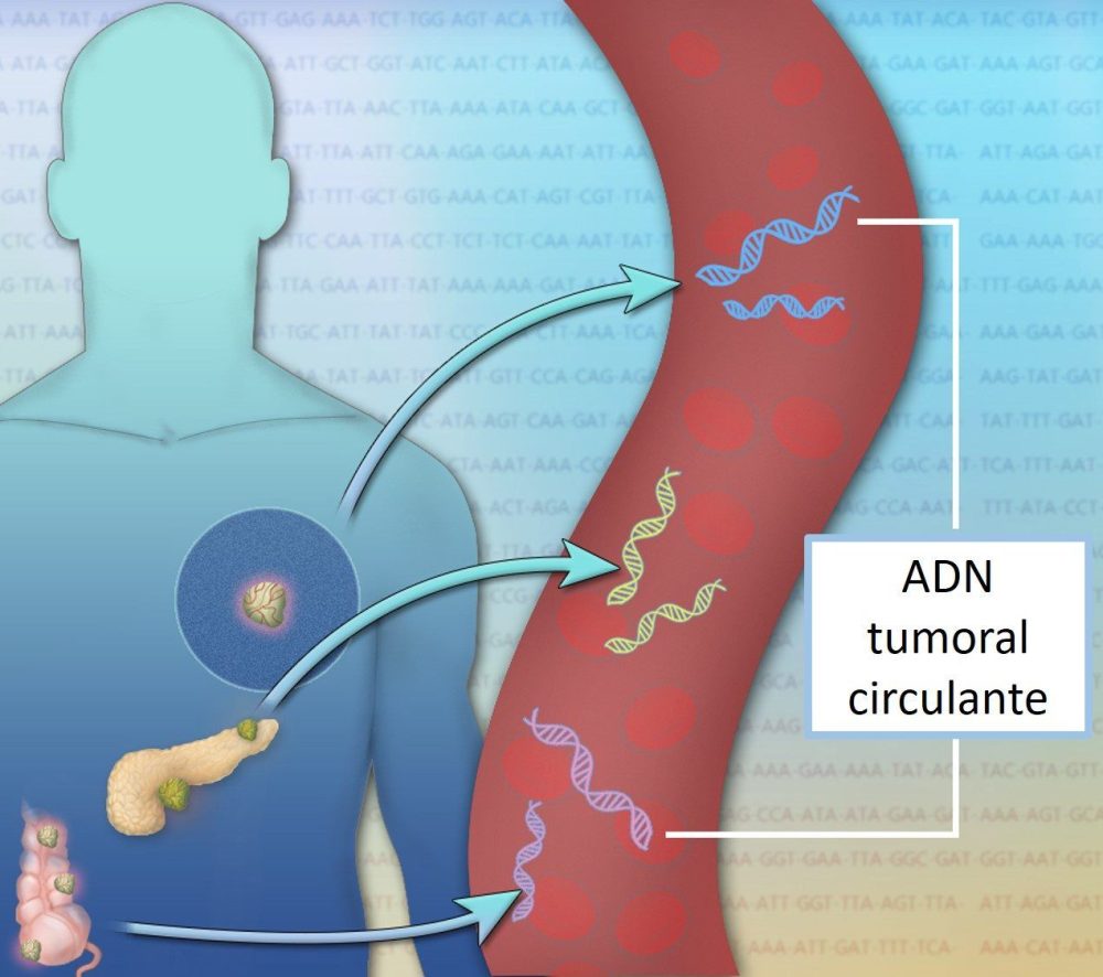 Biopsias líquidas para detectar la aparición de resistencia en cáncer
