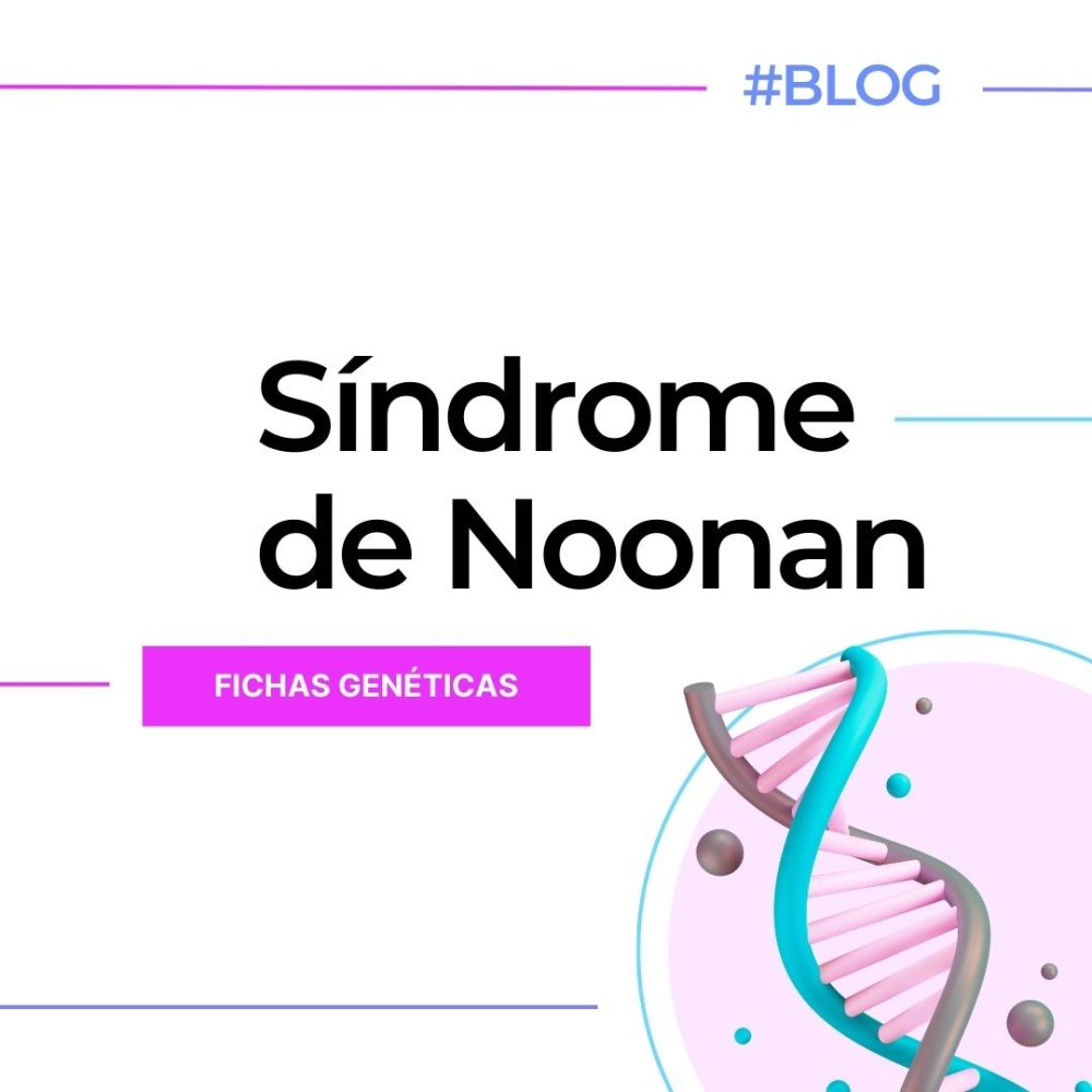 Fichas Genéticas: síndrome de Noonan - Genotipia