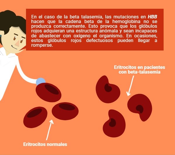 Aprende con la Dra. Santos: beta talasemia - Genotipia