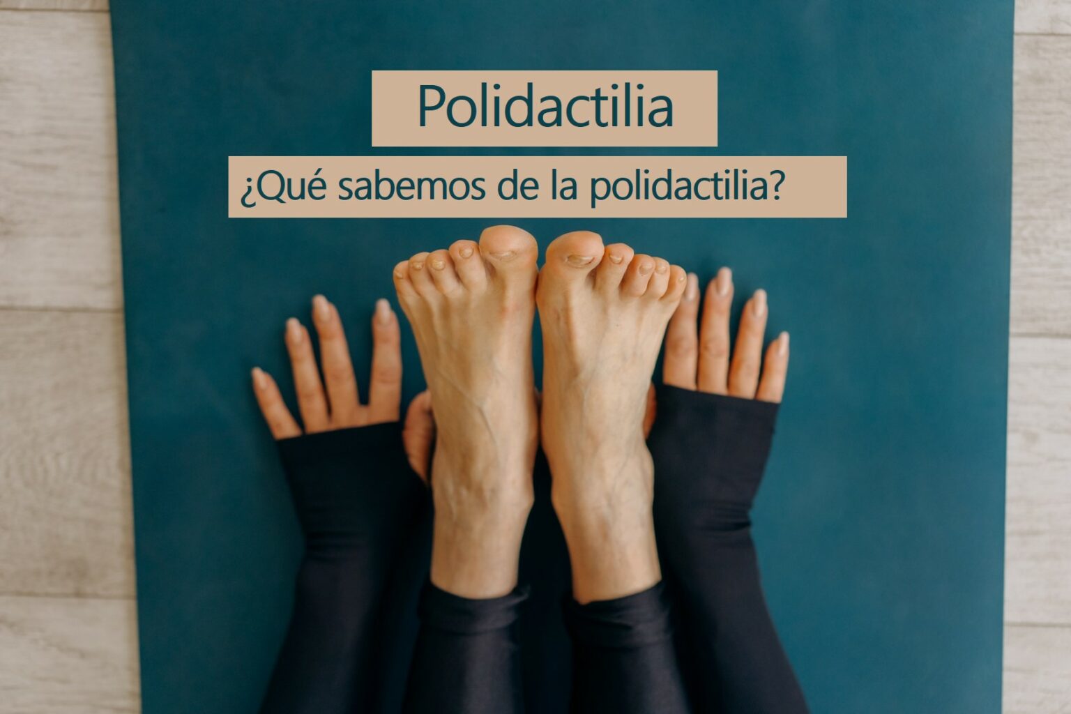 ¿Qué sabemos de la polidactilia? - Genotipia