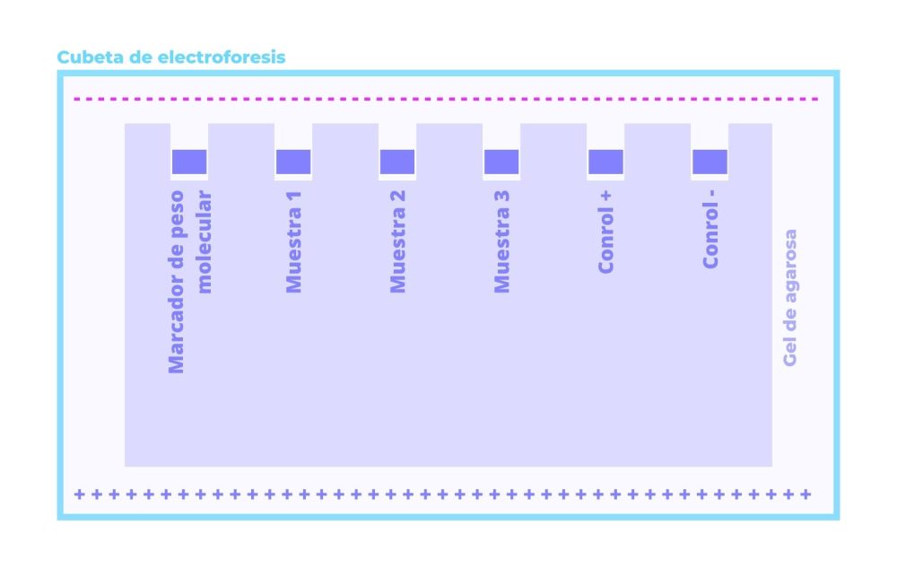 Electroforesis: ¿Qué es y para qué sirve? - Genotipia