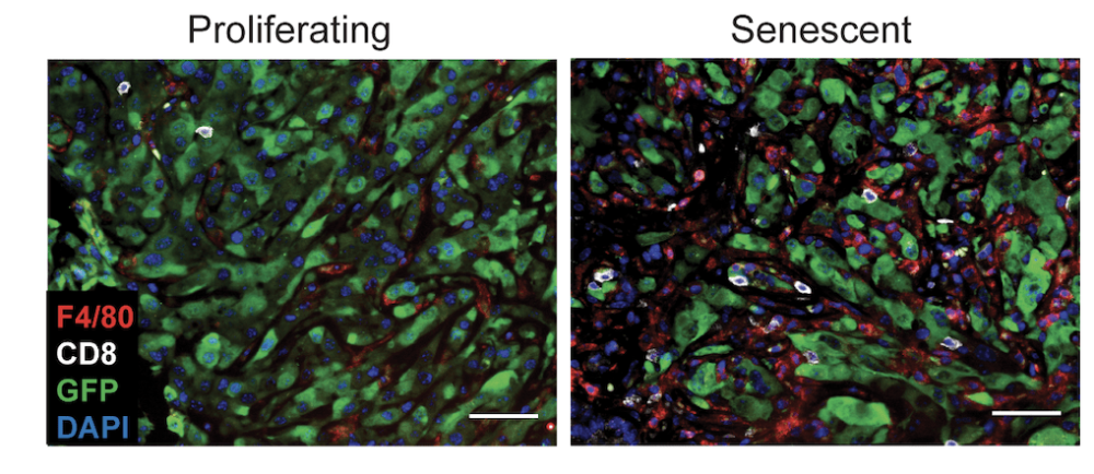 La senescencia altera cómo las células perciben las señales del entorno