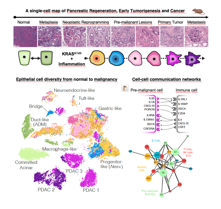 Mapa epigenético del inicio del cáncer de páncreas