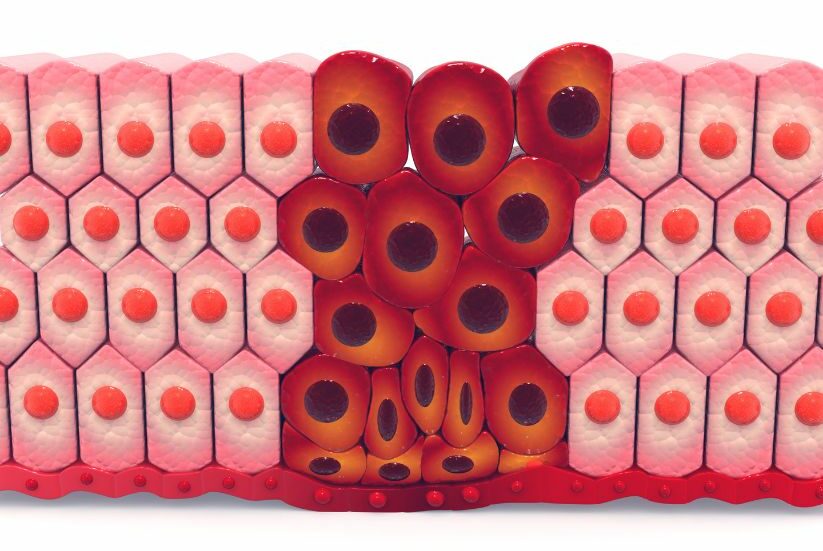 ADN circular extracromosómico y desarrollo tumoral