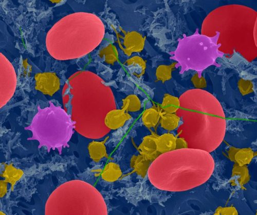 Proteína Relacionada con Función de Plaquetas Mejora Cognición