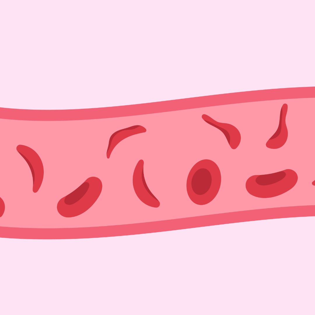 Anemia Falciforme: Primera Enfermedad Tratada con CRISPR