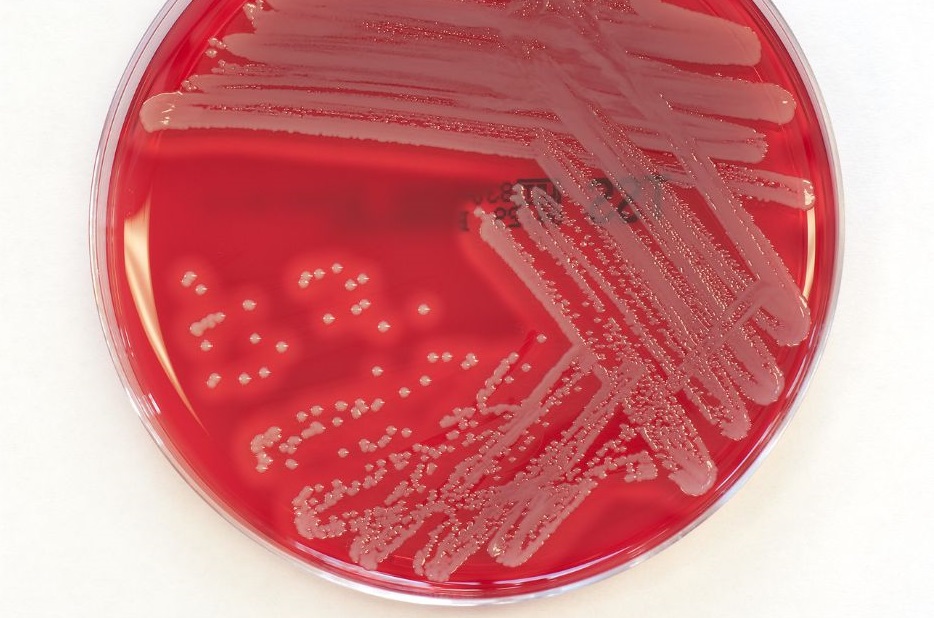 Estafilococo Humano Enfermedades Transmitidas Por Alimentos: